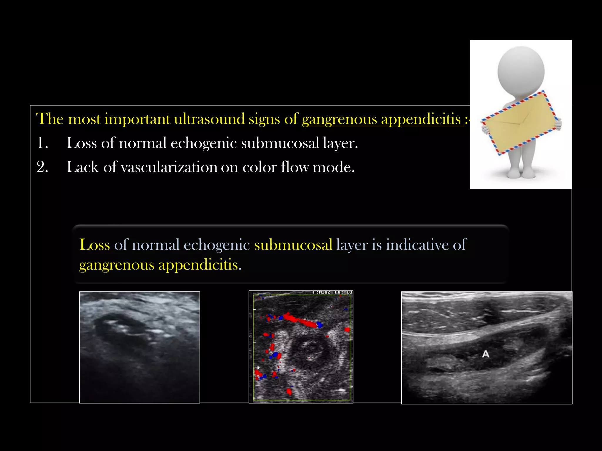 Emergency Ultrasound Course -Lecture 04 -Acute Appendicitis -Part 2 | PDF