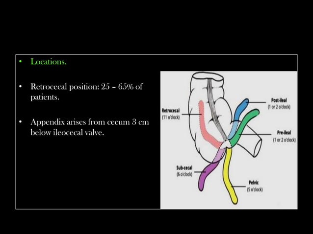 Emergency Ultrasound Course -Lecture 04 -Acute Appendicitis -Part 2 ...