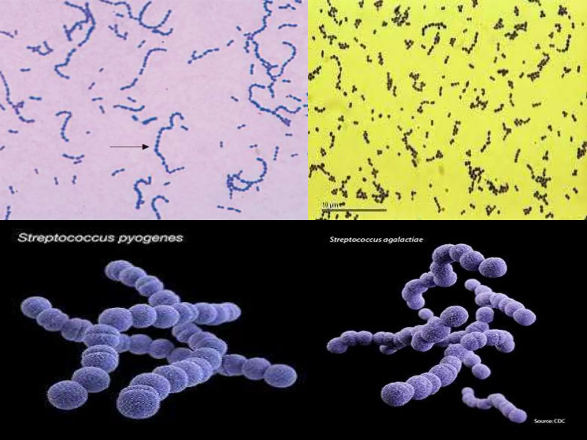 Streptococcus Microbiology Lecture 04 Kmu | PPT