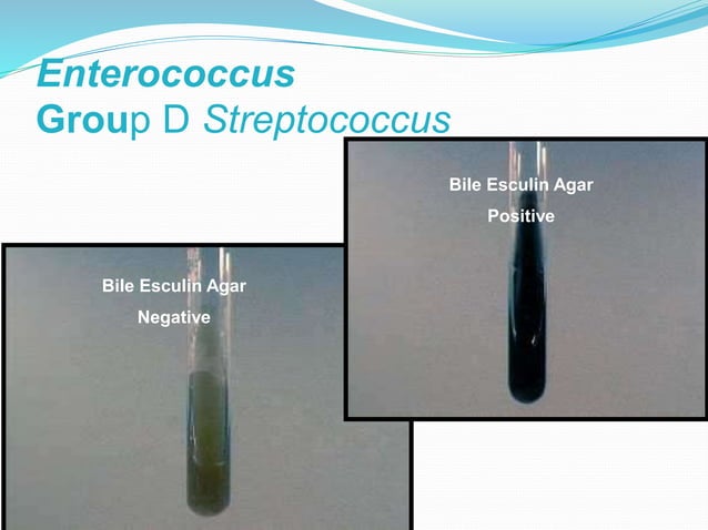 Streptococcus Microbiology Lecture 04 Kmu | PPT