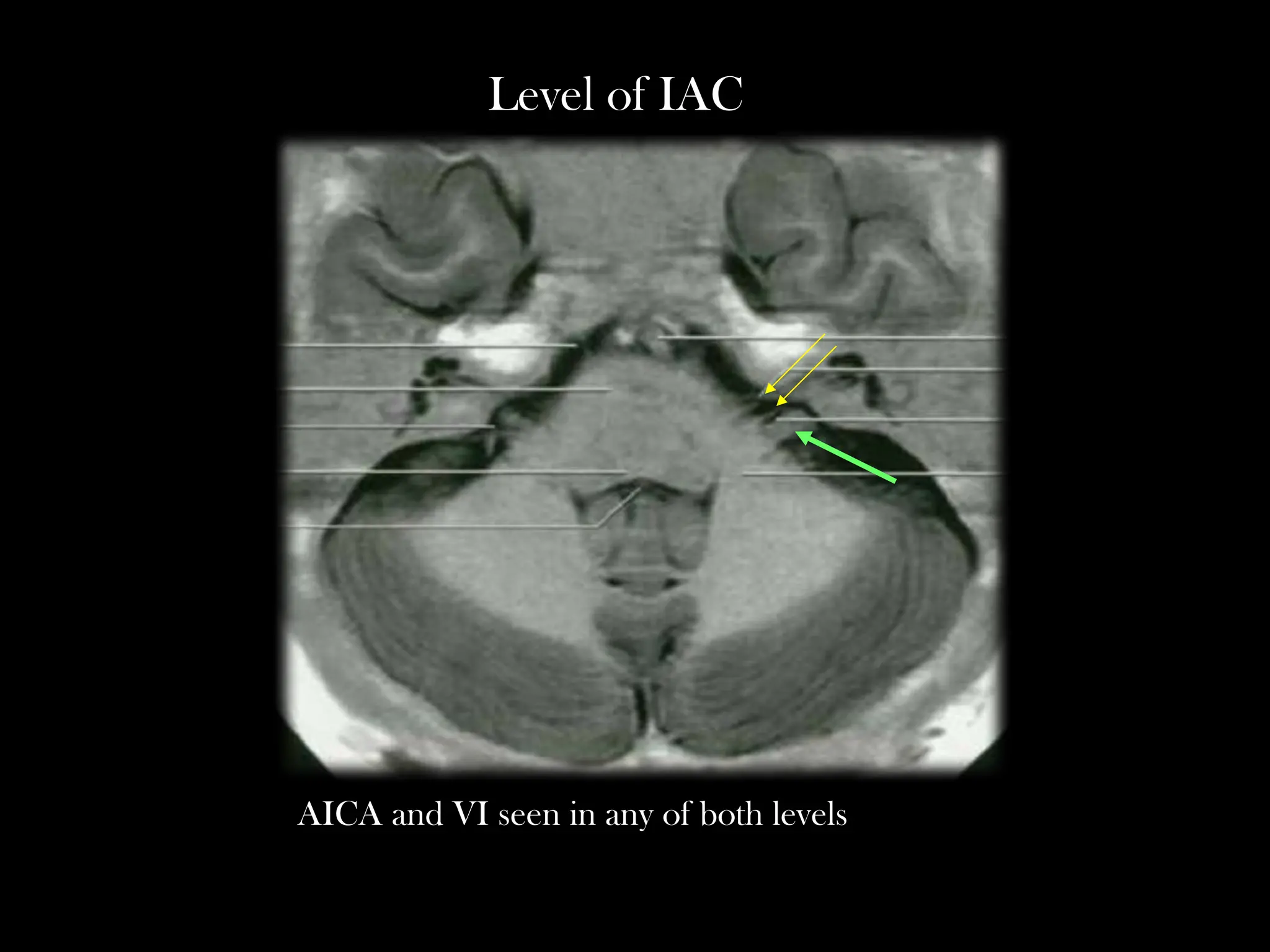 Radiological anatomy of the brain2.pptx