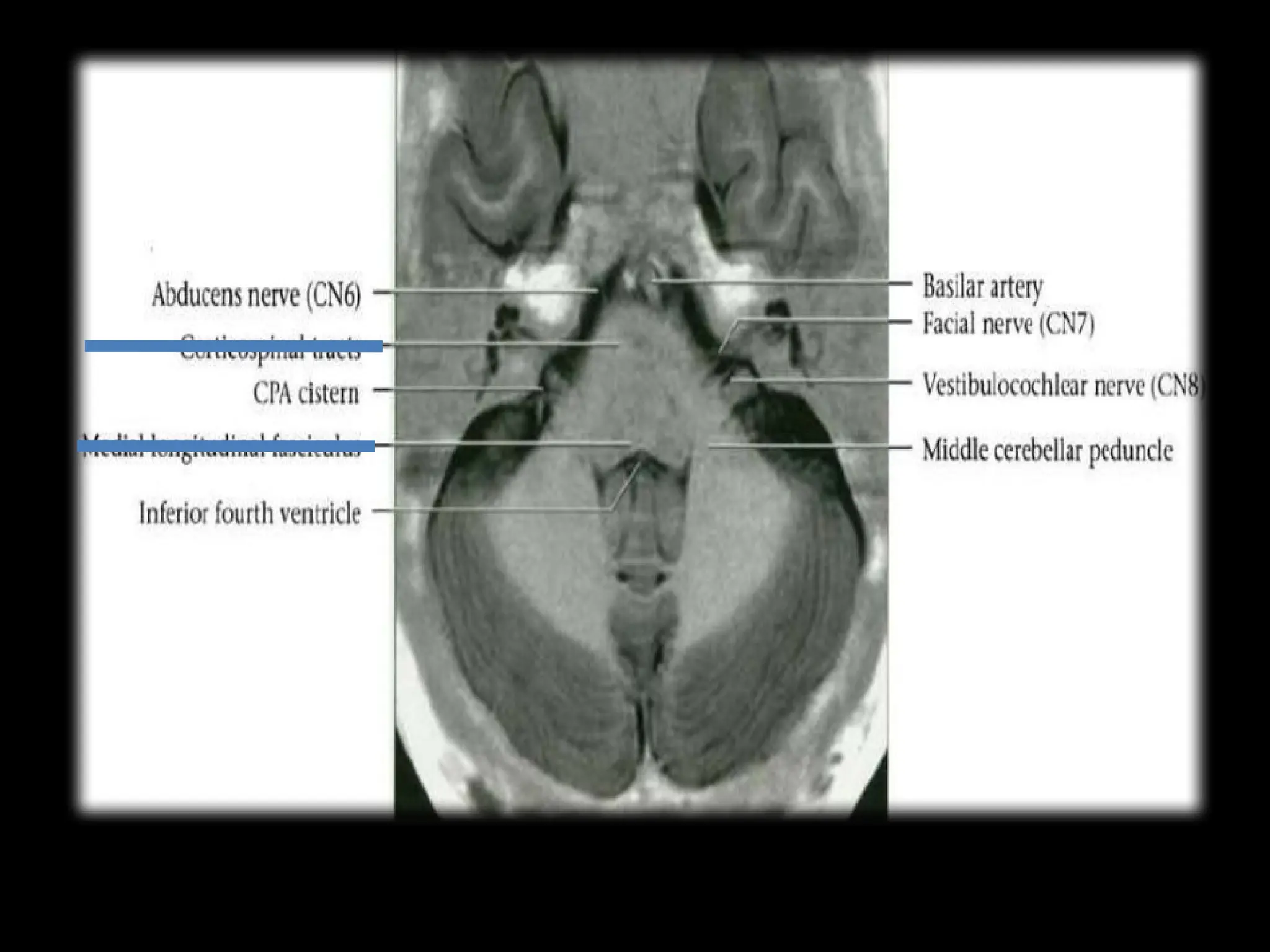 Radiological anatomy of the brain2.pptx