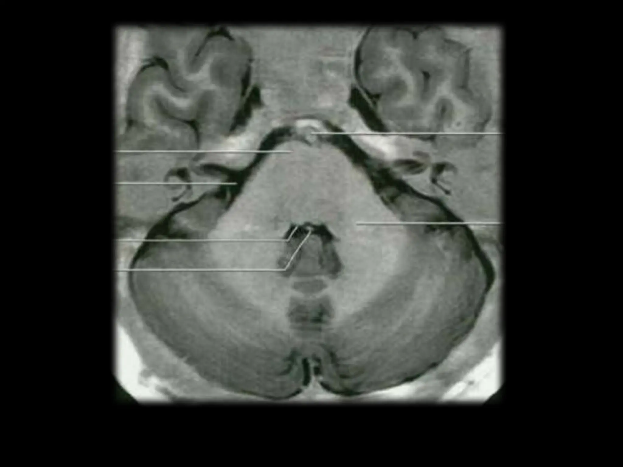 Radiological anatomy of the brain2.pptx