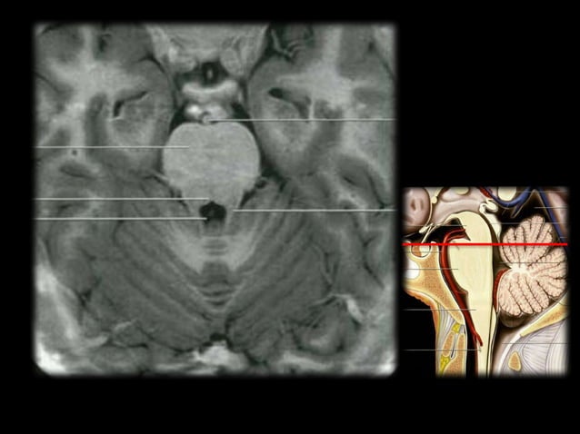 Radiological anatomy of the brain2.pptx