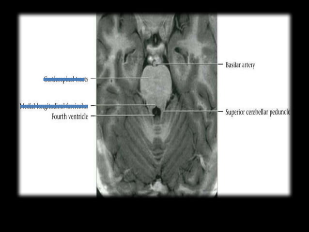 Radiological anatomy of the brain2.pptx