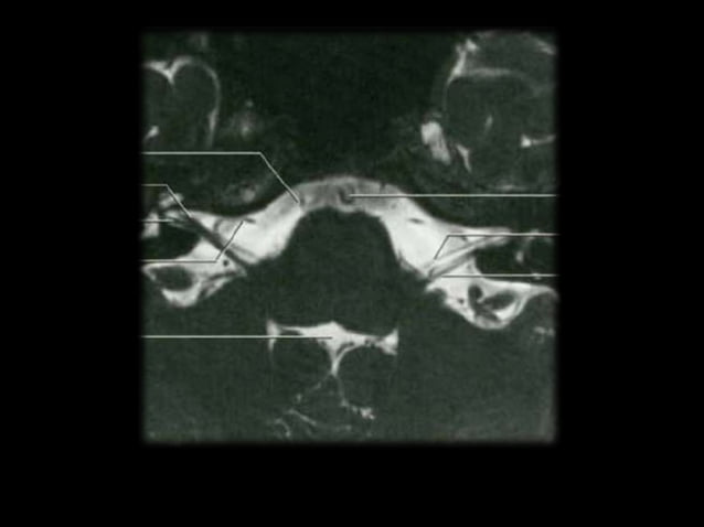Radiological anatomy of the brain2.pptx