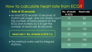 Electrocardiography Basics | PPT