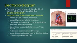 Electrocardiography Basics | PPT