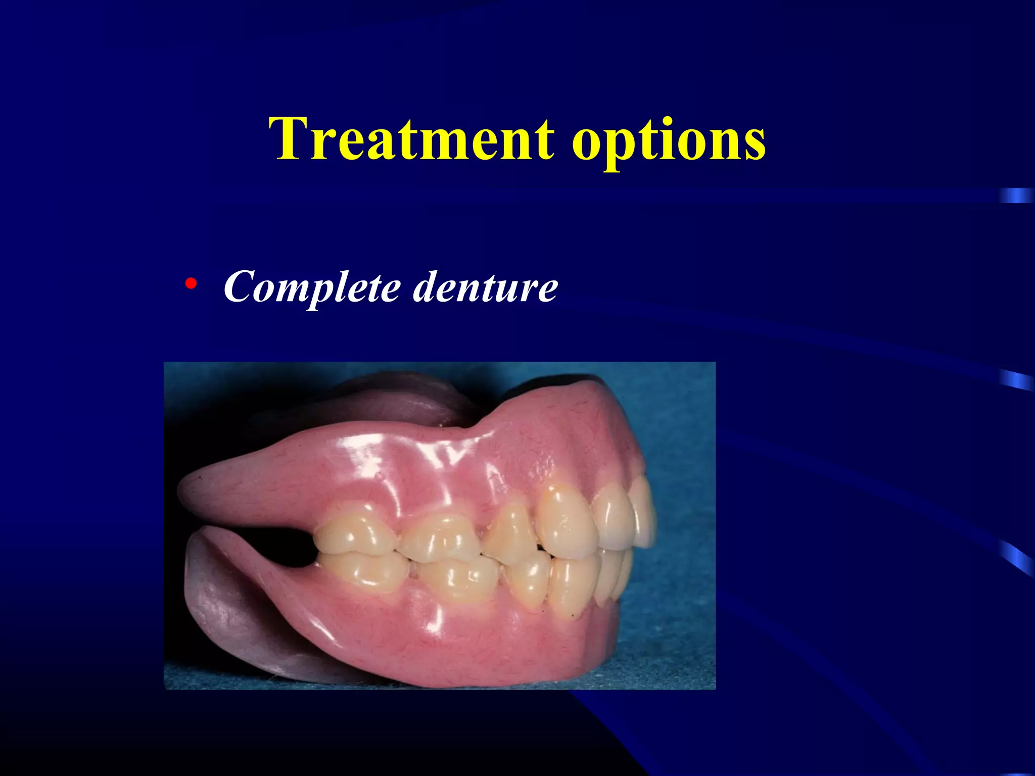 Complete denture - Introduction to Prosthodontics | PPT
