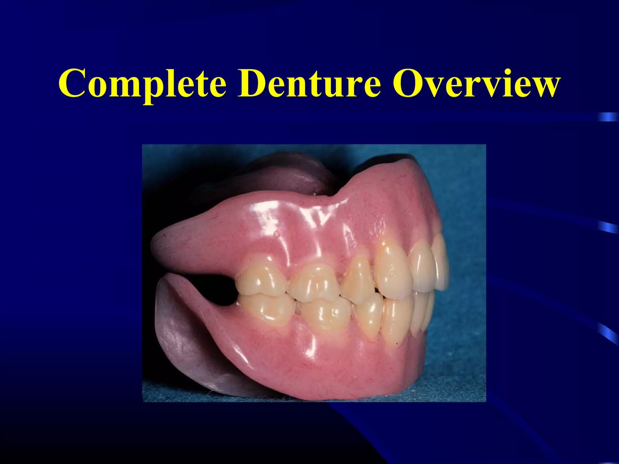 Complete denture - Introduction to Prosthodontics | PPT