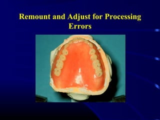 Complete denture - Introduction to Prosthodontics | PPT