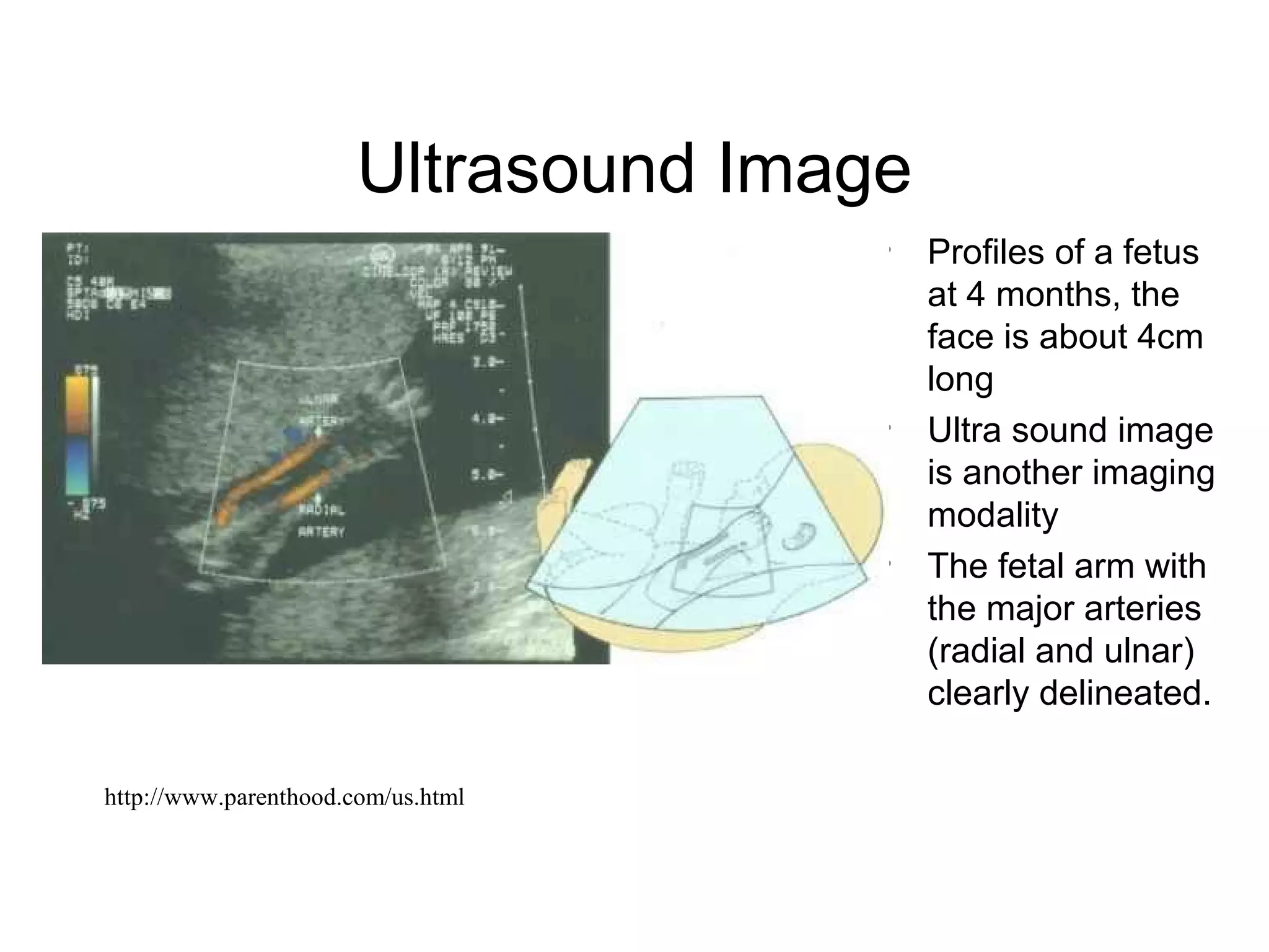 Introduction to image processing | PPT