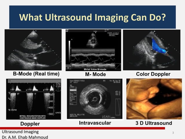 Medical Equipment Ultrasound Lecture 1 | PDF