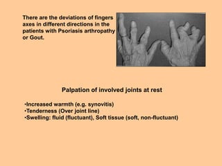 Joint Disorders Lecture 1 | PPT