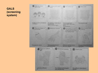 Joint Disorders Lecture 1 | PPT