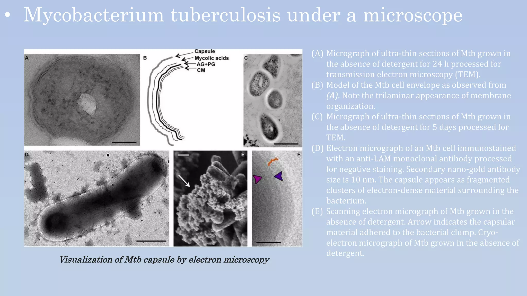 Definition of tuberculosis as scientific and practical problem | PPTX