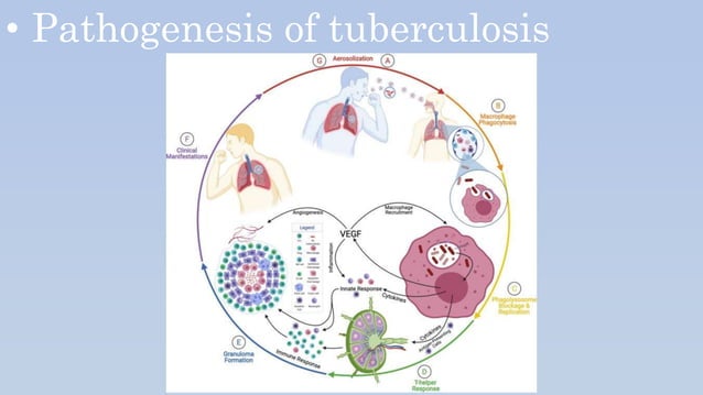 Definition of tuberculosis as scientific and practical problem | PPT