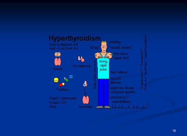 drugs used in hyperthyroidism | PPT