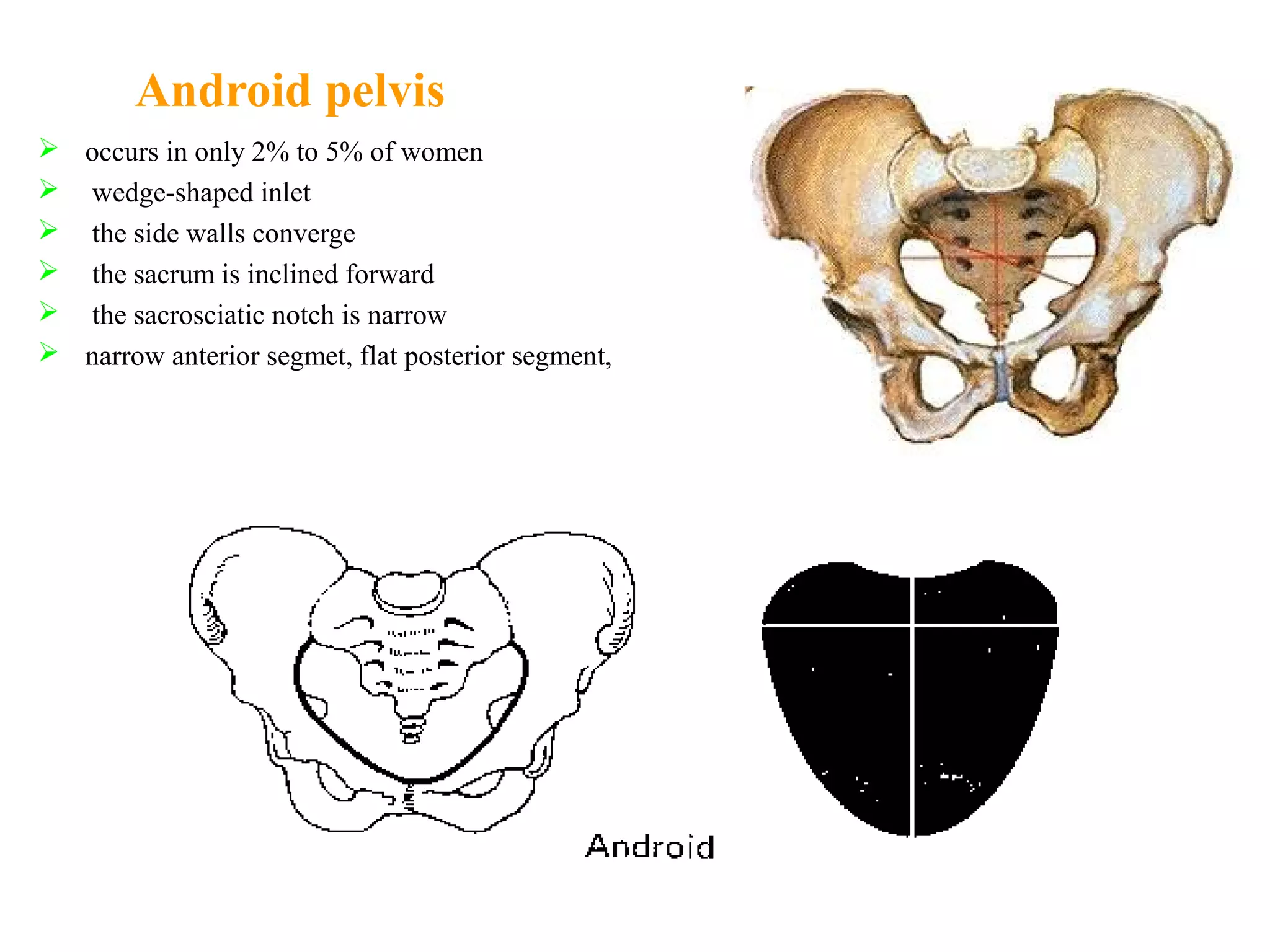 CLINICAL ANATOMY OF PELVIS | PPT