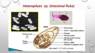 lecture10-Heterophyiasis (1).pptx | Digestive Disorders | Diseases and ...