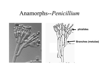 Lecture 10- Medical Mycoloy- Aspergillosis.ppt