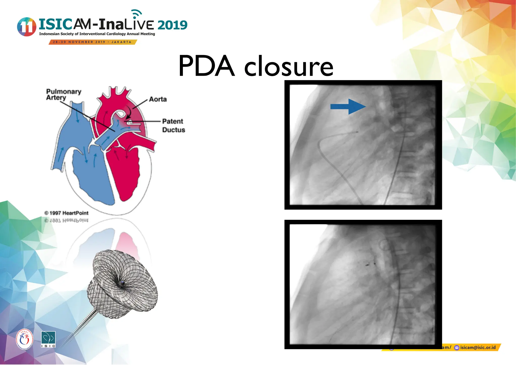 LECTURE 10 - PEDIATRIC cardiology CATH LAB.pdf