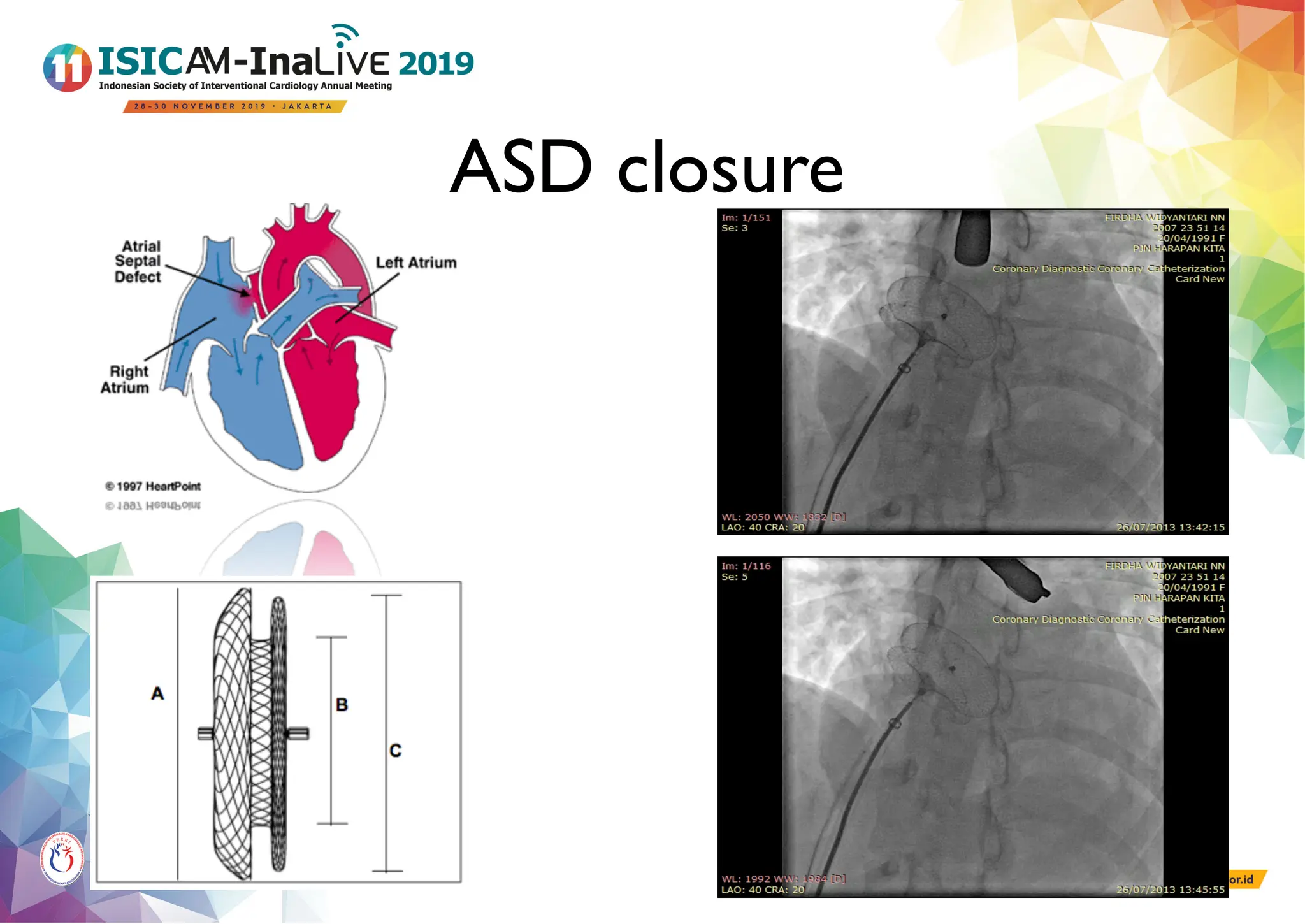 LECTURE 10 - PEDIATRIC cardiology CATH LAB.pdf