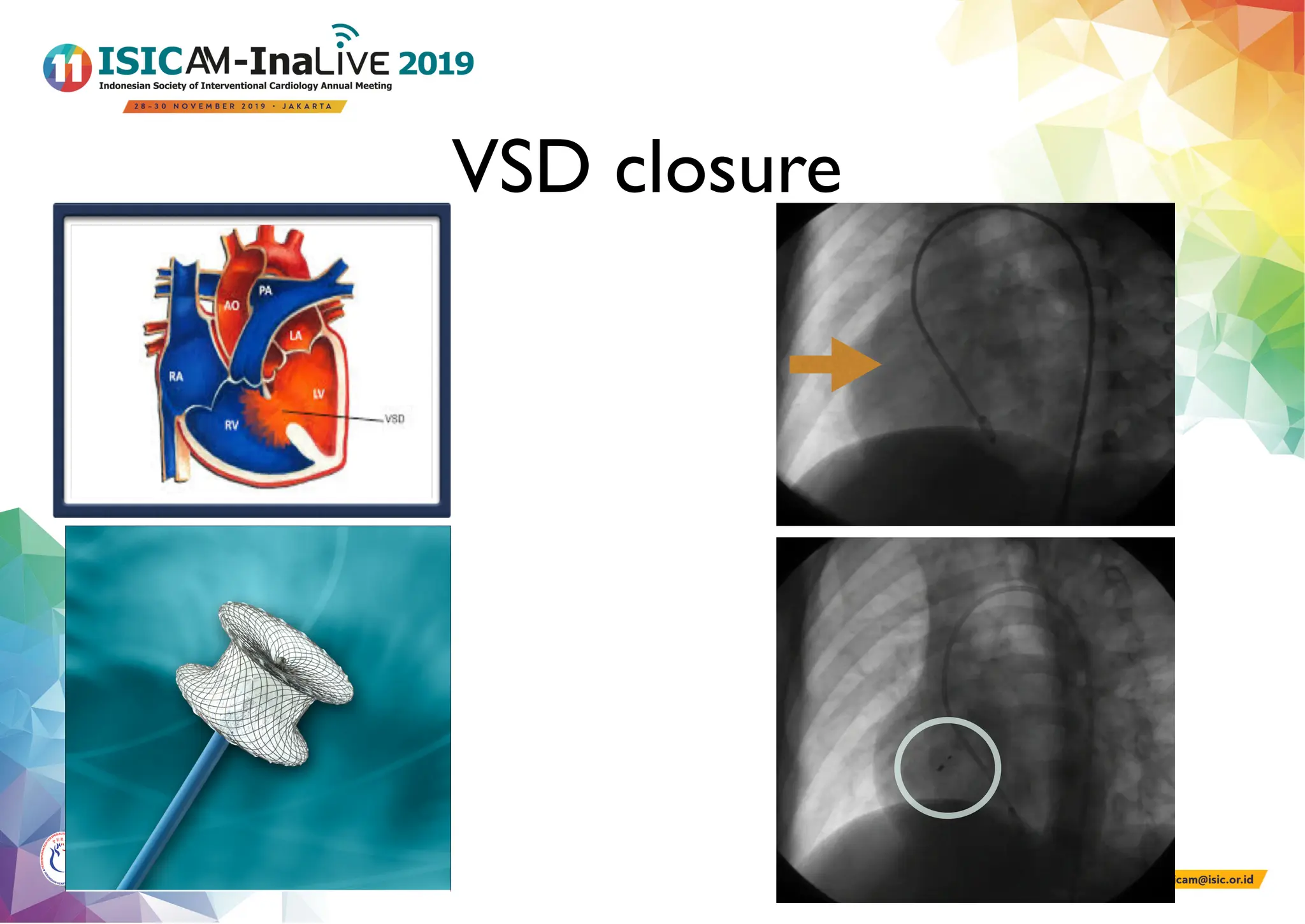LECTURE 10 - PEDIATRIC cardiology CATH LAB.pdf