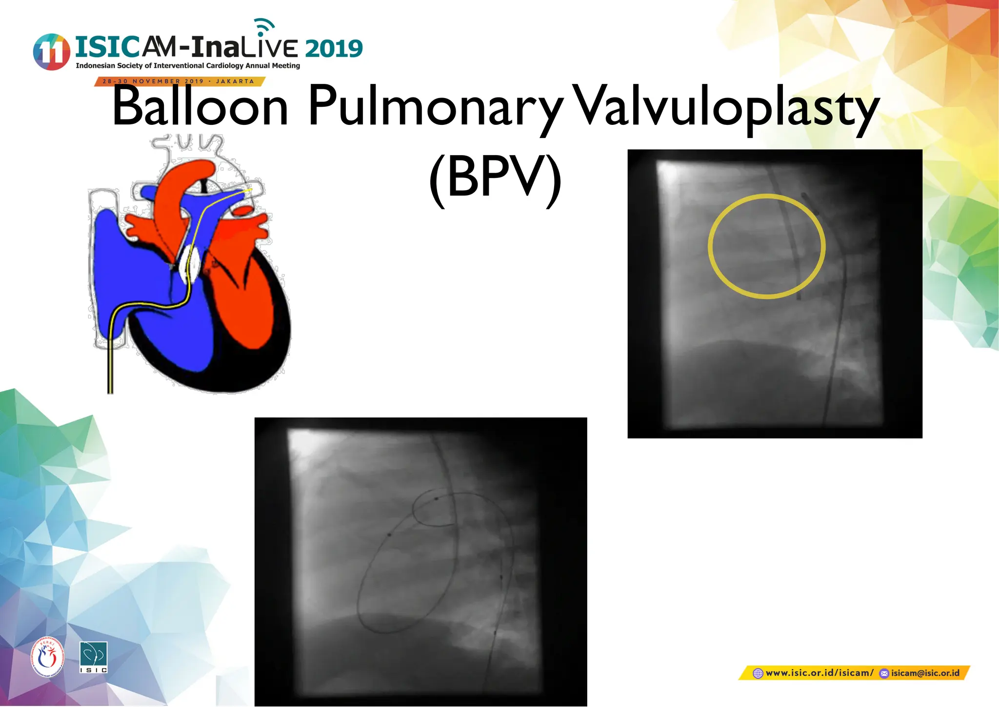 LECTURE 10 - PEDIATRIC cardiology CATH LAB.pdf