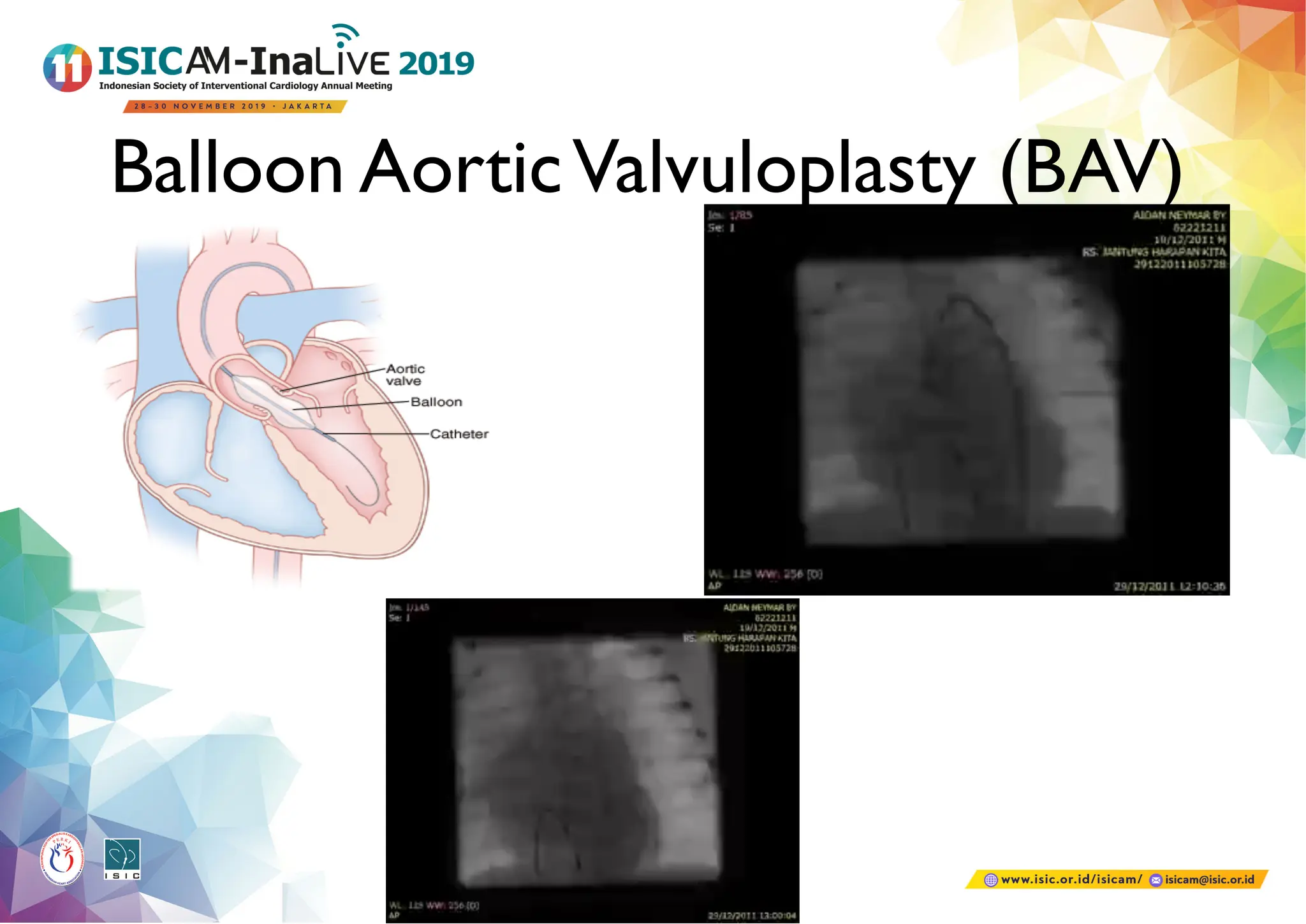 LECTURE 10 - PEDIATRIC cardiology CATH LAB.pdf