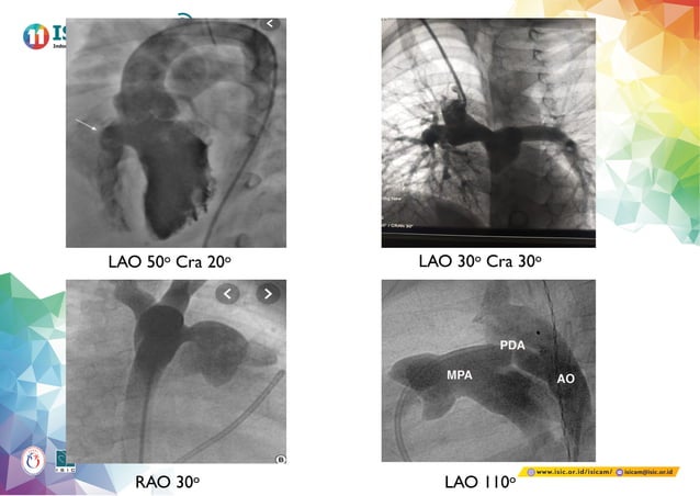 LECTURE 10 - PEDIATRIC cardiology CATH LAB.pdf