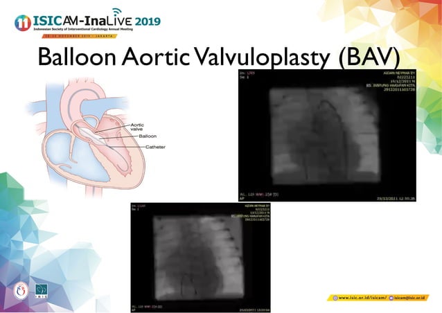 LECTURE 10 - PEDIATRIC cardiology CATH LAB.pdf
