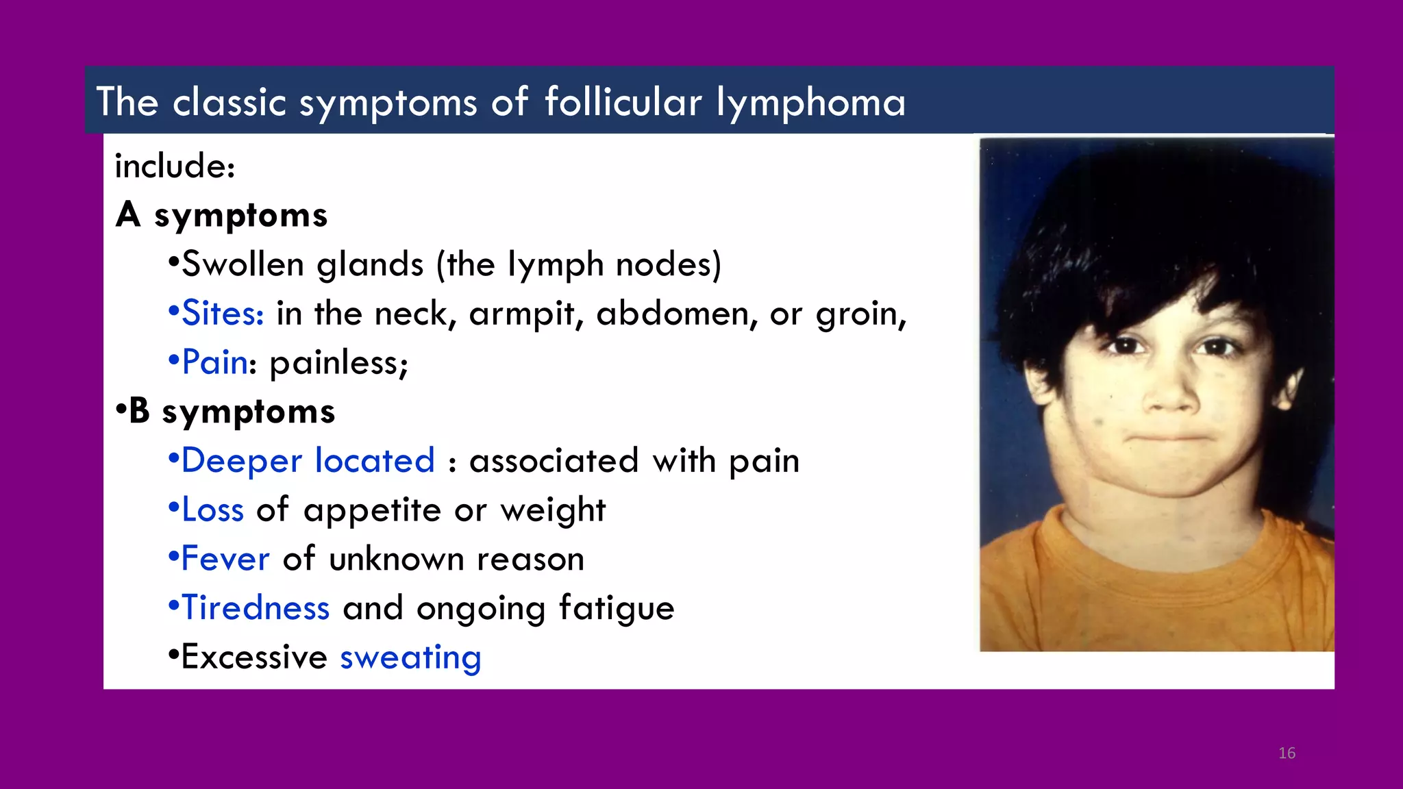 Pediatric Non Hodgkin lymphoma NEW.pdf