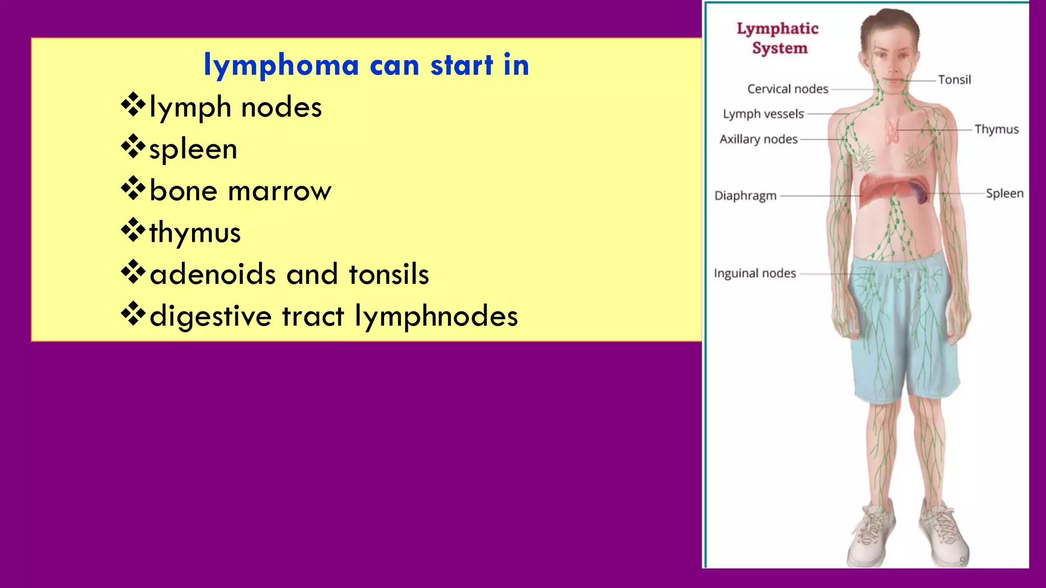 Pediatric Non Hodgkin lymphoma NEW.pdf