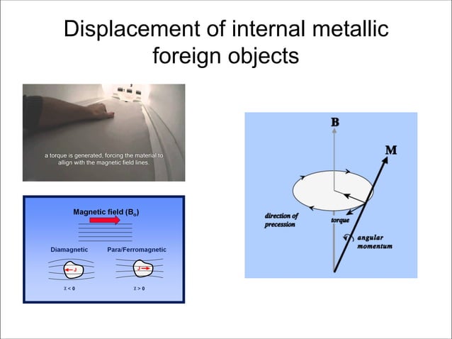 Lecture 10 MRI safety and precautions.pdf