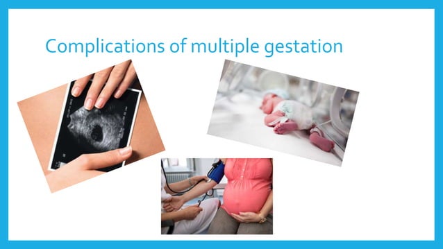 Lecture 10 Multifetal pregnancy | PPTX