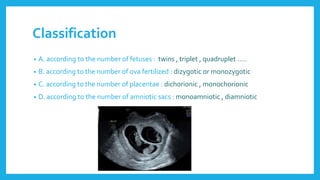 Lecture 10 Multifetal pregnancy | PPTX