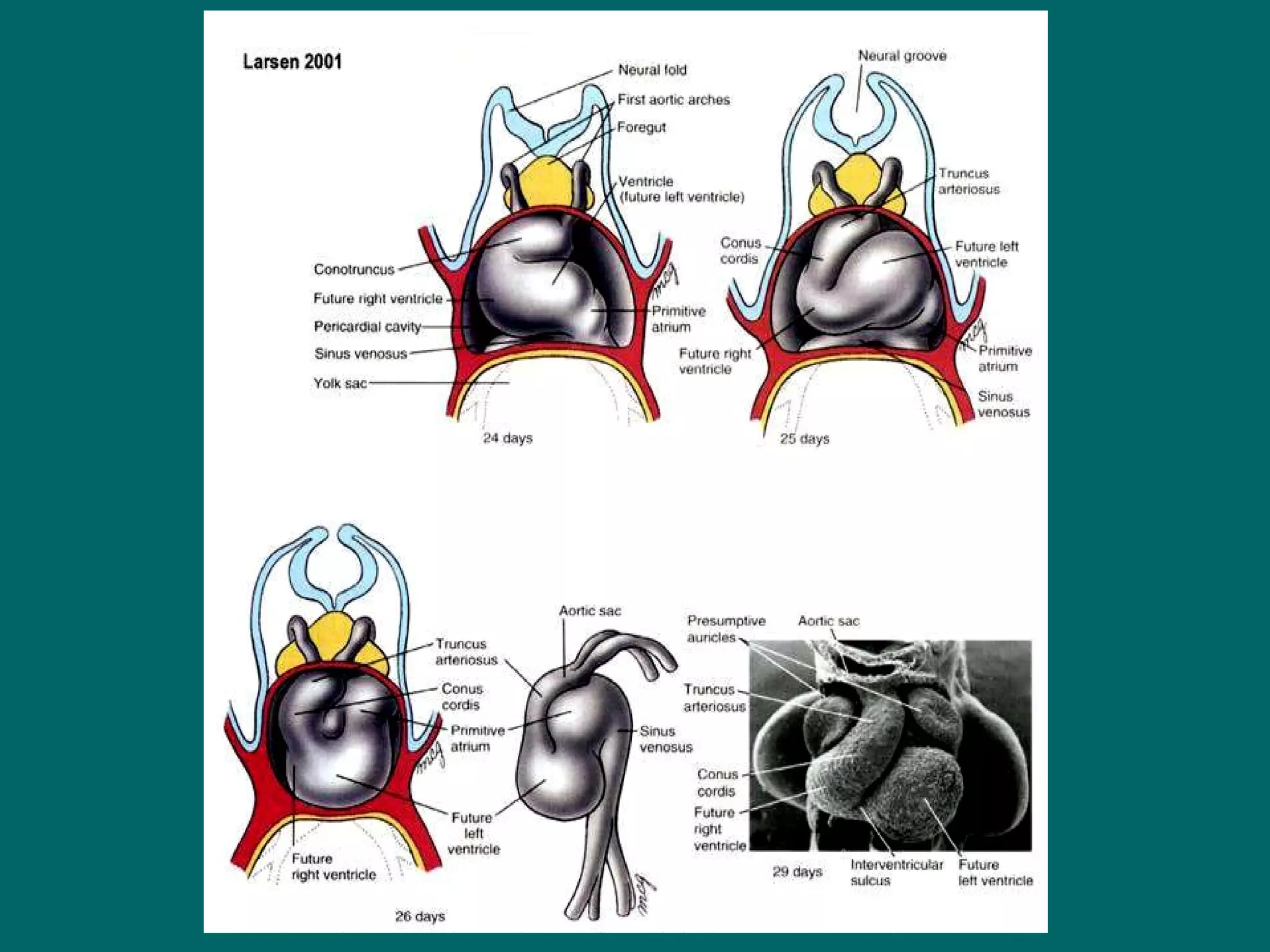 Lecture11 development of the heart and blood vessels | PPT