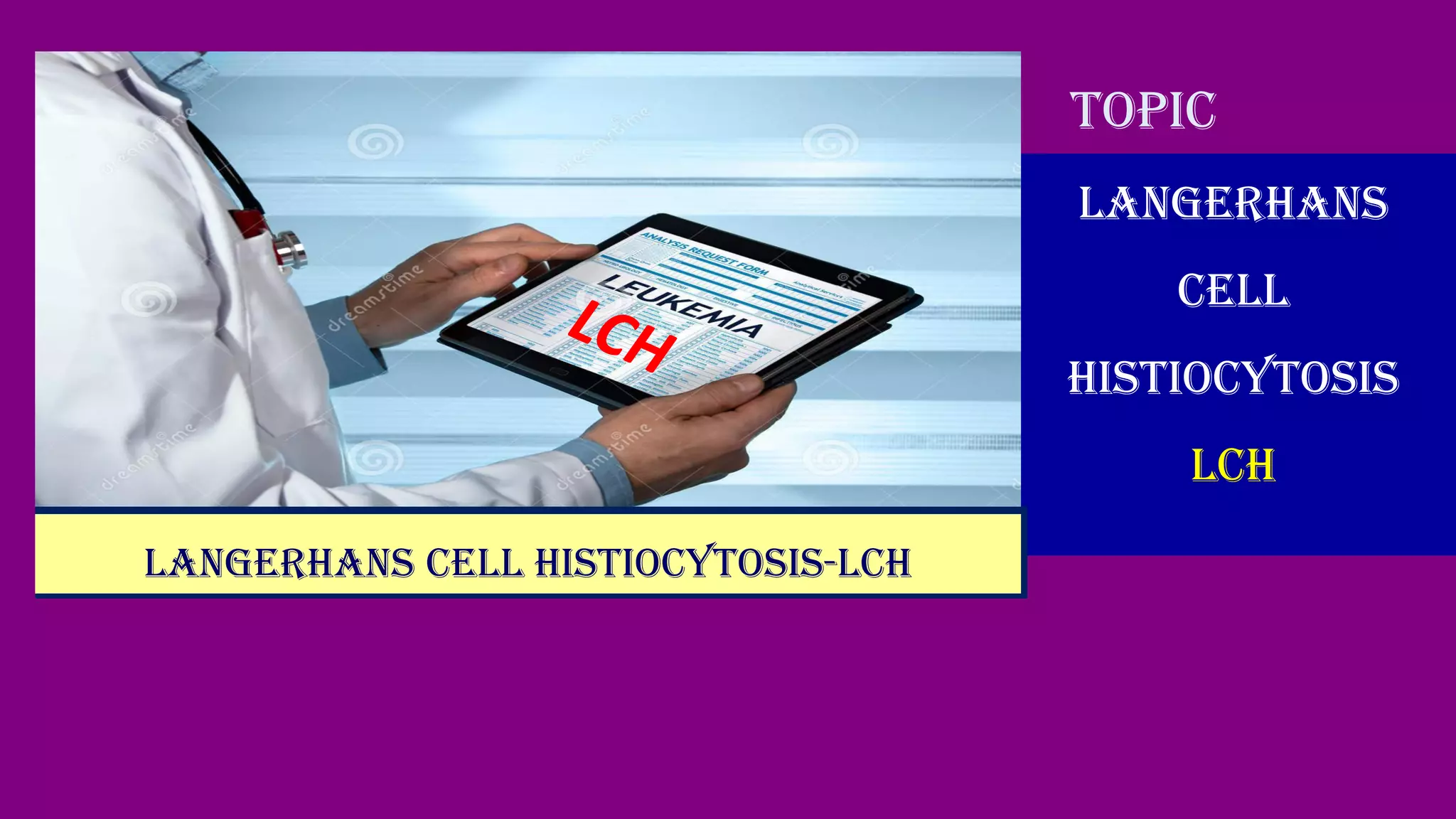 Langerhans Cell Histiocytosis (LCH).pdf