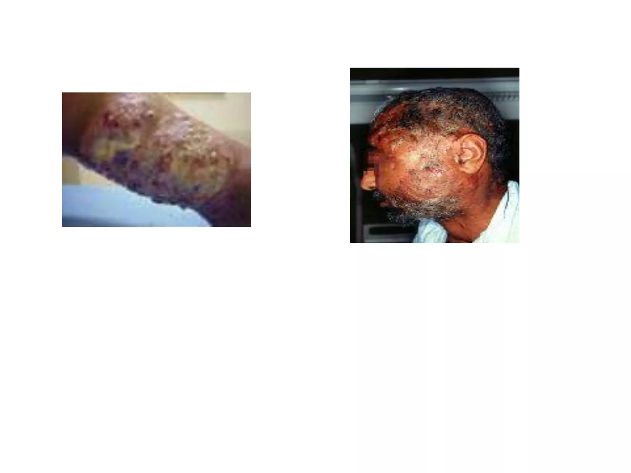 Lecture 11- Medical Mycology- Filamentous Fungi.ppt