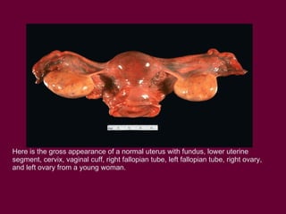 Anatomy Of Female Genital Tract | PPT