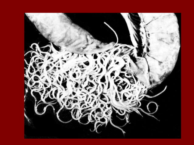 Lecture 11,ascaridida, parascaris, hetarakis | PPT | Digestive ...