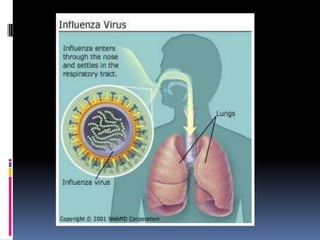 Influenza | PPT