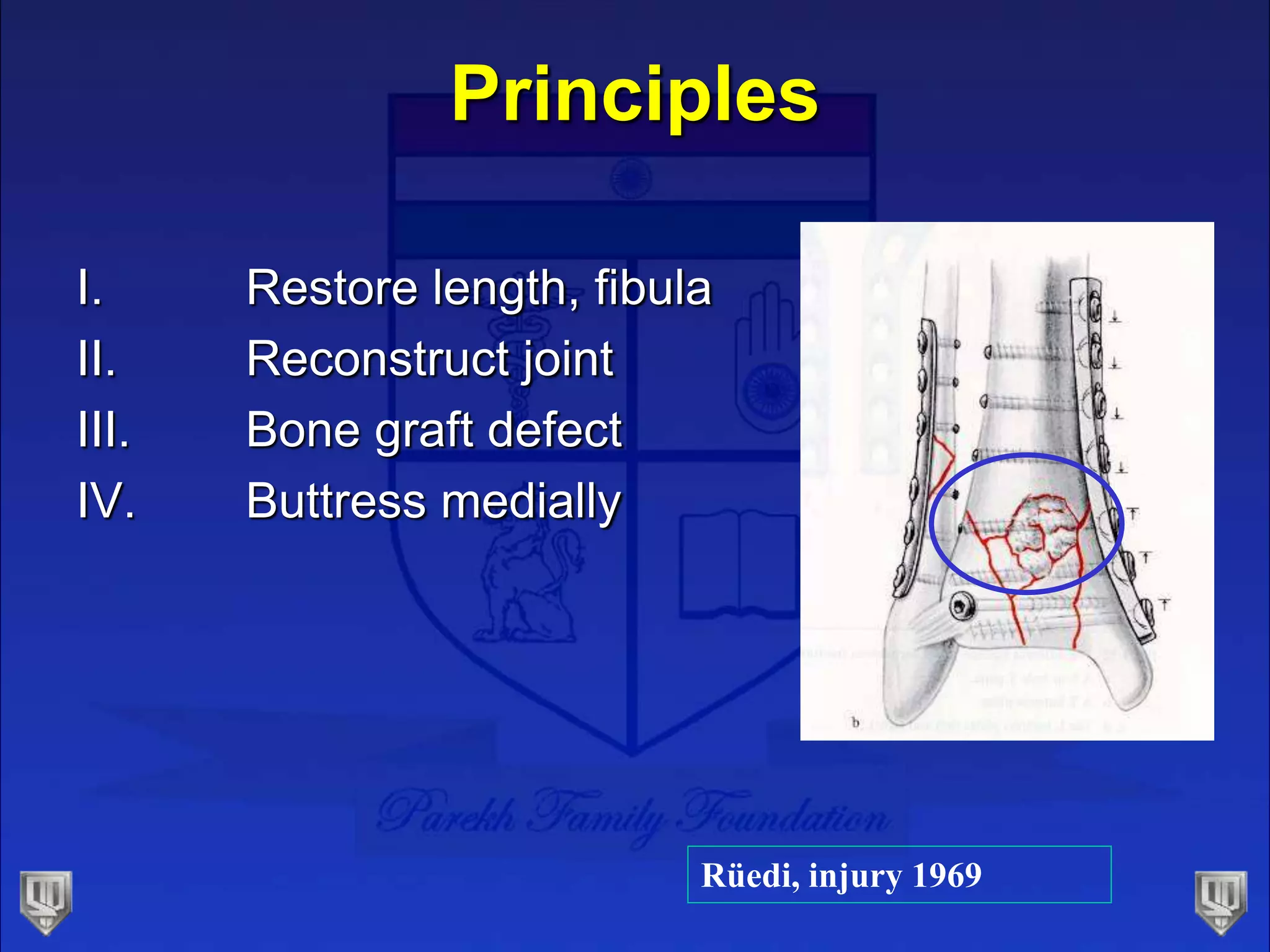 Lecture 11 parekh pilon | PPT