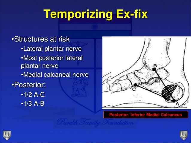 Lecture 11 parekh pilon