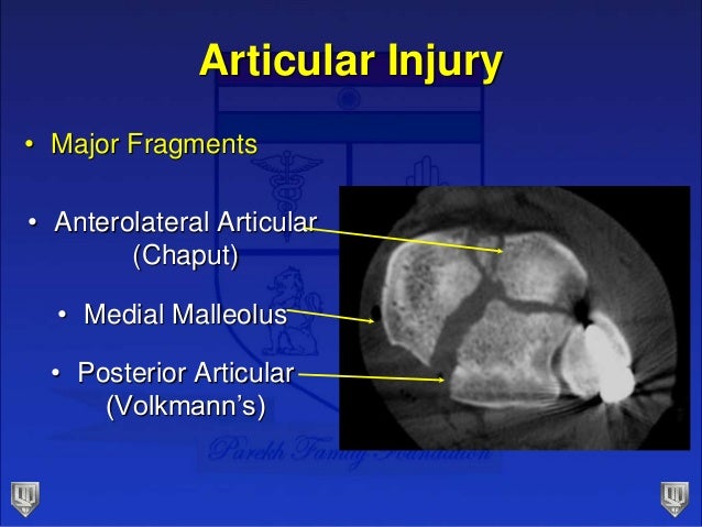 Lecture 11 parekh pilon