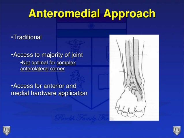 Lecture 11 parekh pilon