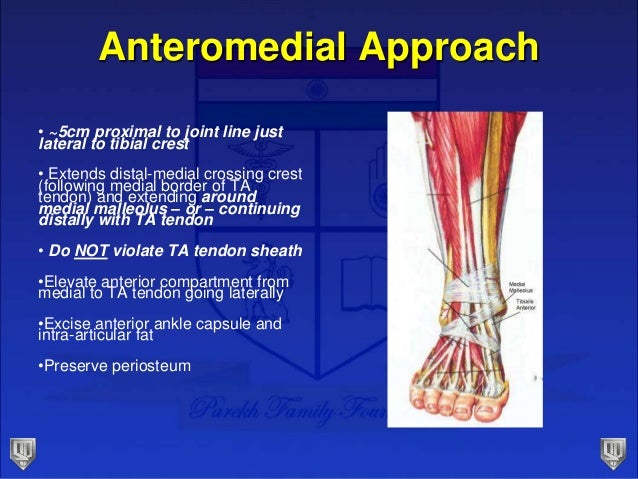 Lecture 11 parekh pilon