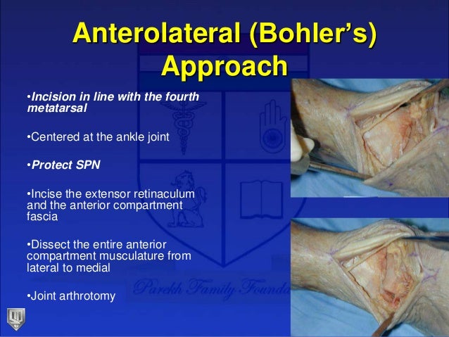 Lecture 11 parekh pilon