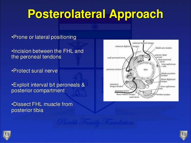 Lecture 11 parekh pilon
